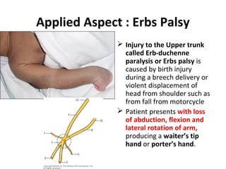 Axilla & brachial plexus | PPT