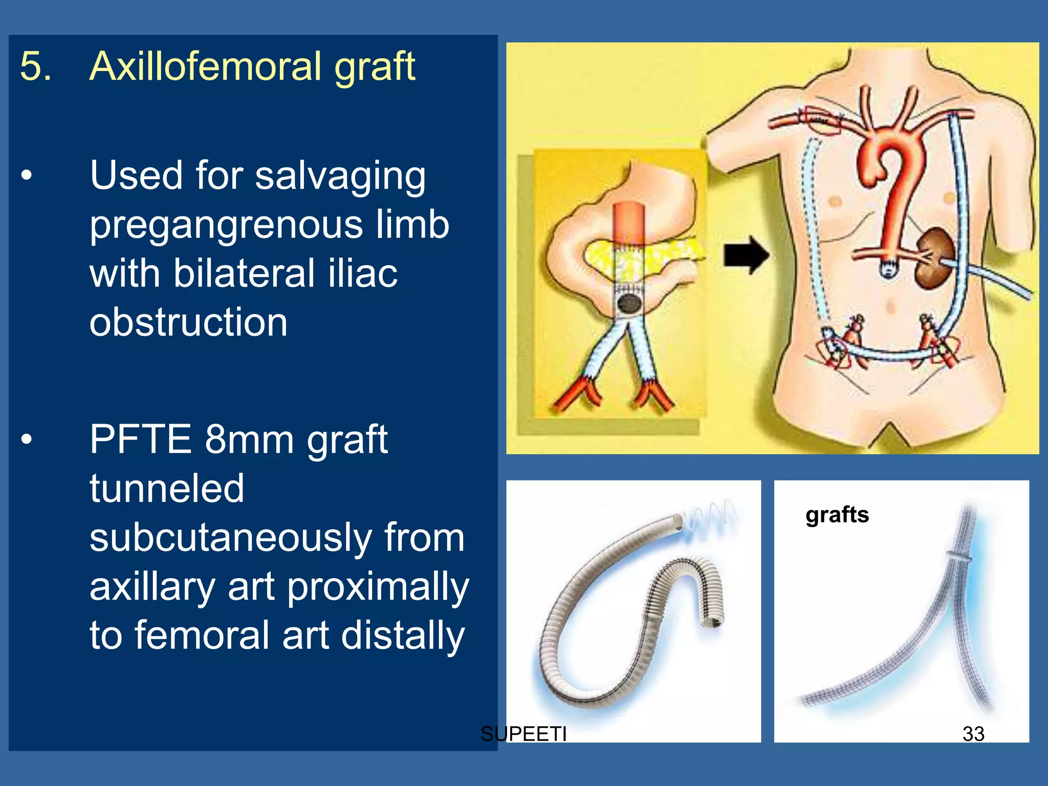 AXILLARY ARTERY.ppt