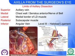 axillary dissection-current Place in breast cancer staging.pptx