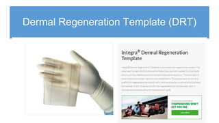 Axillary Hidradenitis Reconstruction Using a Dermal Regeneration ...