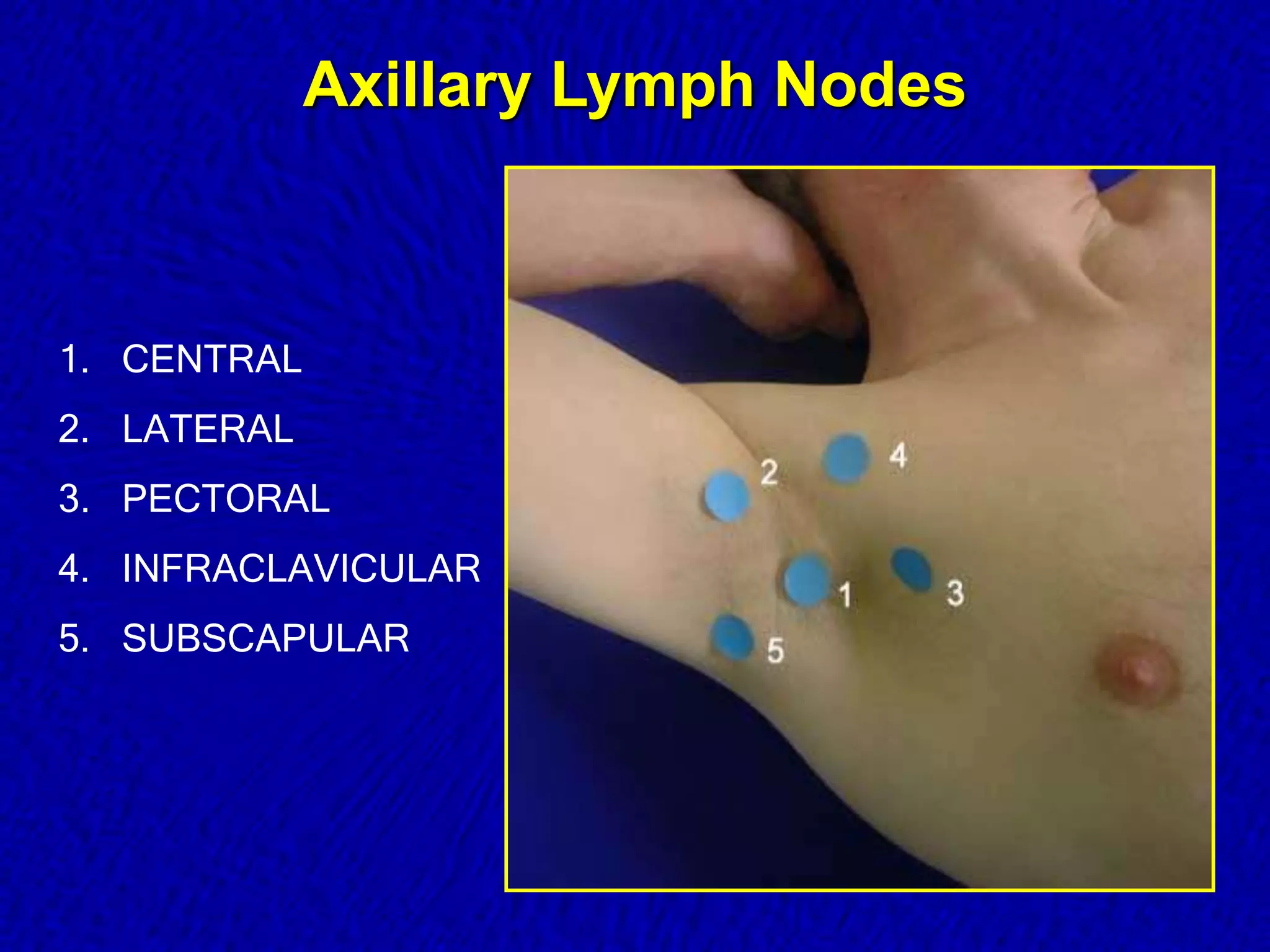 Axillary Lymph Nodes Examination.pptx