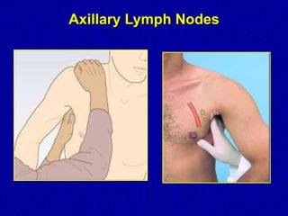 Axillary Lymph Nodes Examination.pptx