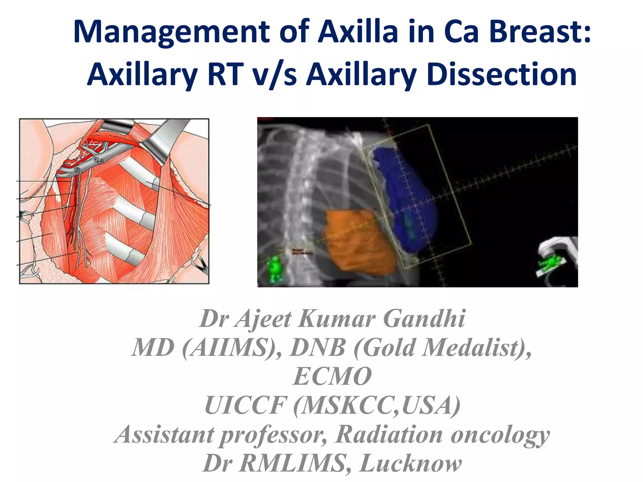 Axillary radiotherapy versus axillary surgery in breast cancer | PPTX