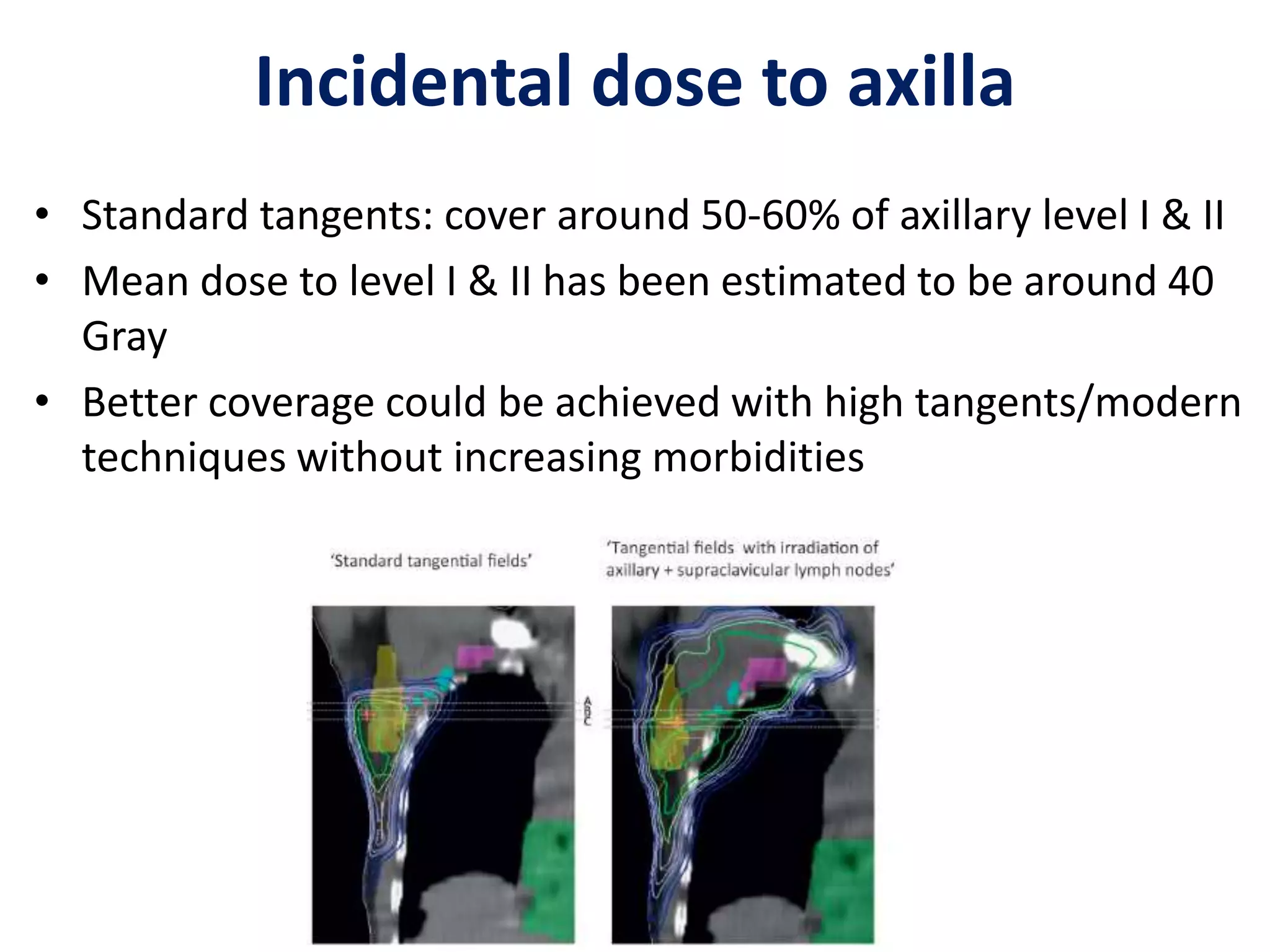 Axillary radiotherapy versus axillary surgery in breast cancer | PPTX