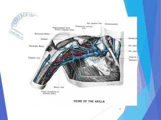 Axillary Vein Thrombosis.pdf