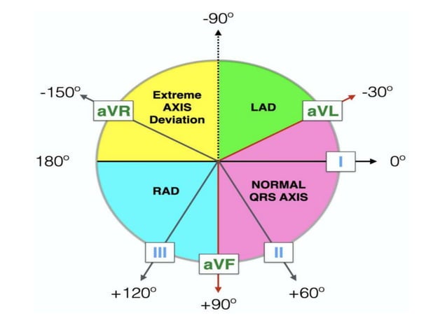AXIS, TYPES OF AXIS IN ECG AND HOW TO INTERPRET IN ECG? | PPTX