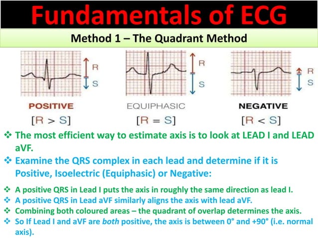 Cardiac axis abnormalities in ECG | PPTX