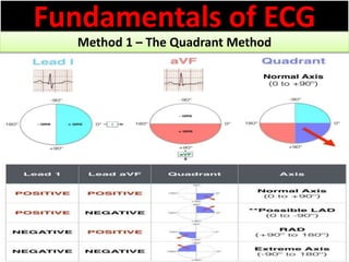 Cardiac axis abnormalities in ECG | PPTX