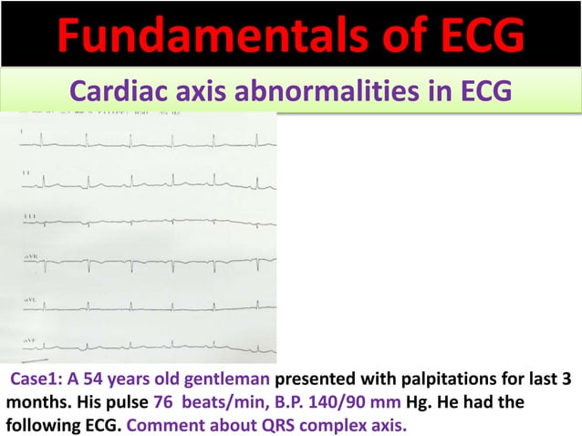Cardiac axis abnormalities in ECG | PPTX