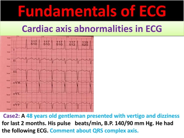 Cardiac axis abnormalities in ECG | PPTX