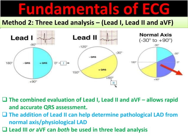 Cardiac axis abnormalities in ECG | PPTX