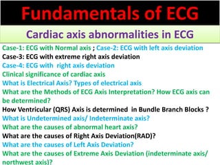 Cardiac axis abnormalities in ECG | PPTX