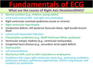 Cardiac axis abnormalities in ECG | PPTX