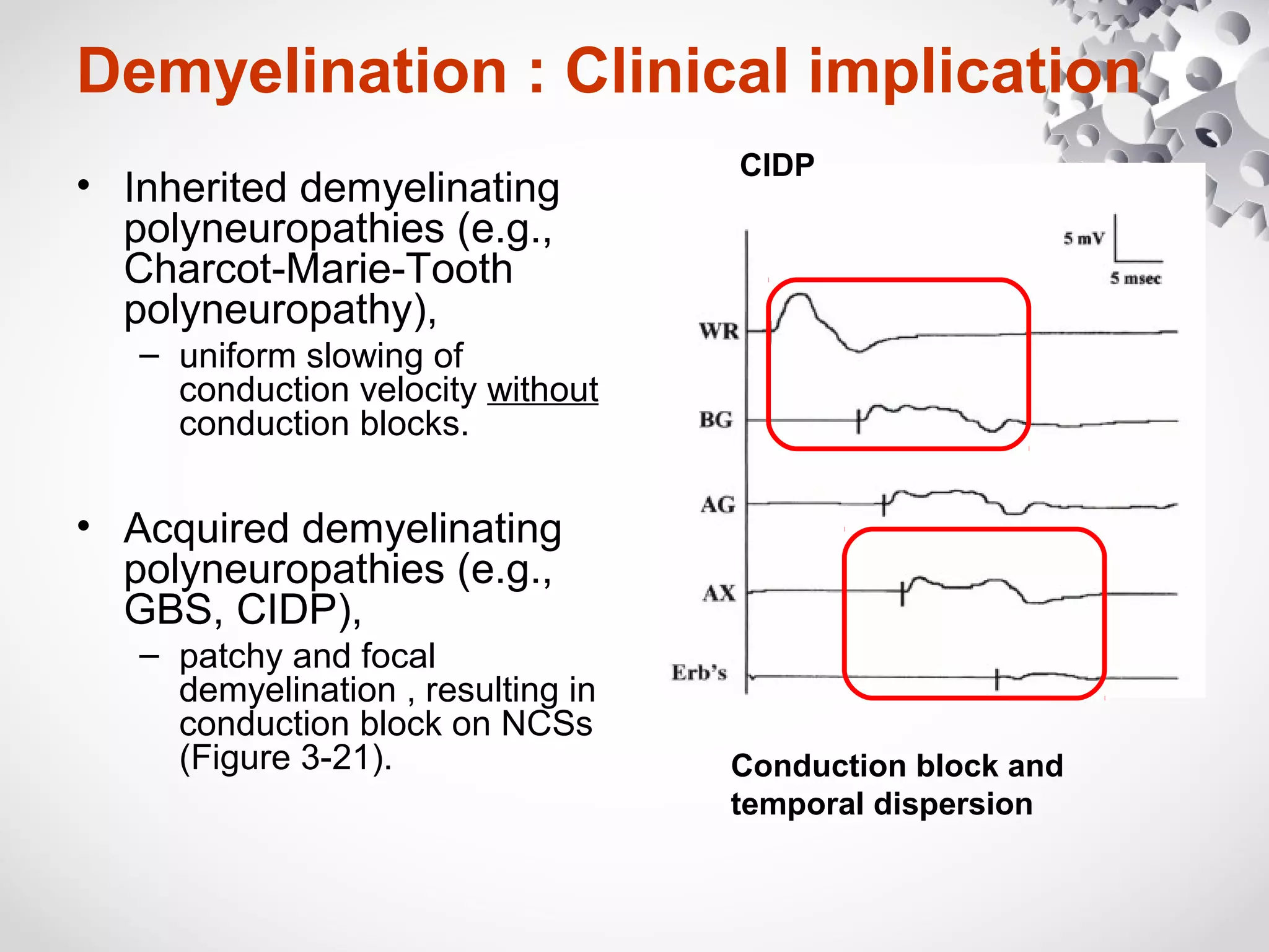 Nerves conduction study, Axonal loss vs Demyelination | PPT