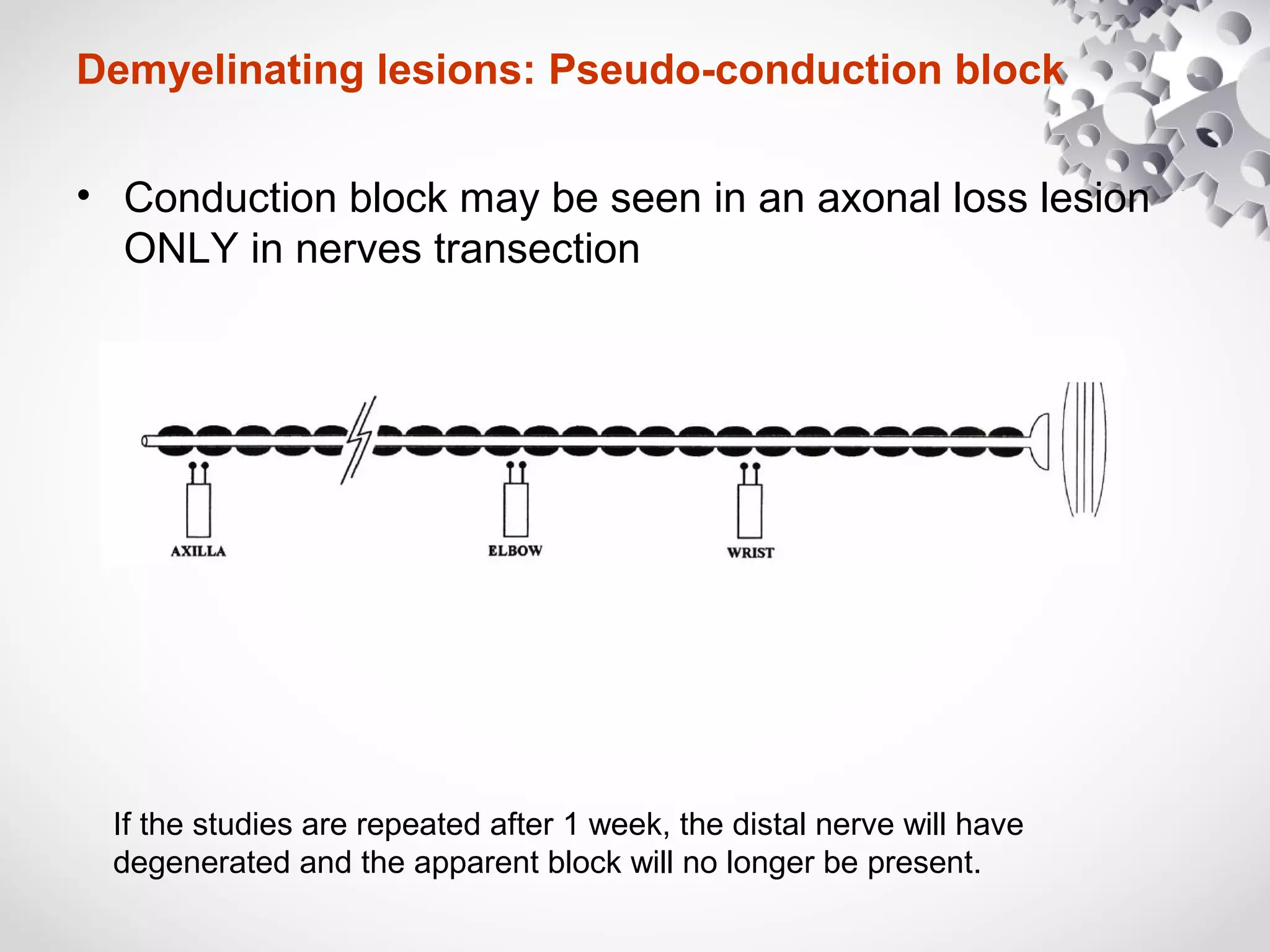 Nerves conduction study, Axonal loss vs Demyelination | PPT