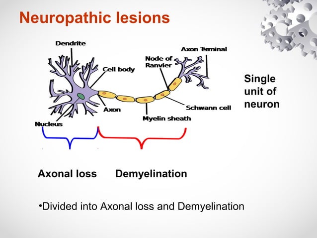Nerves conduction study, Axonal loss vs Demyelination | PPT