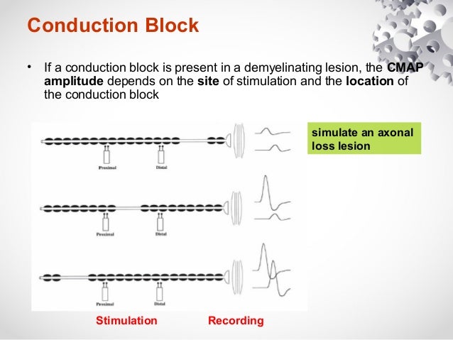 Nerves conduction study, Axonal loss vs Demyelination