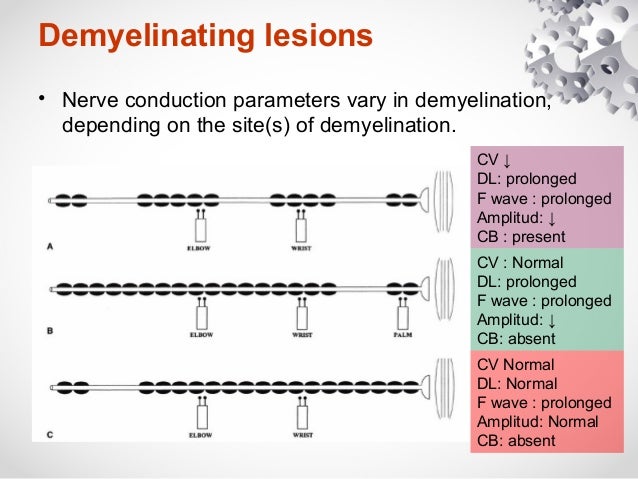 Nerves conduction study, Axonal loss vs Demyelination