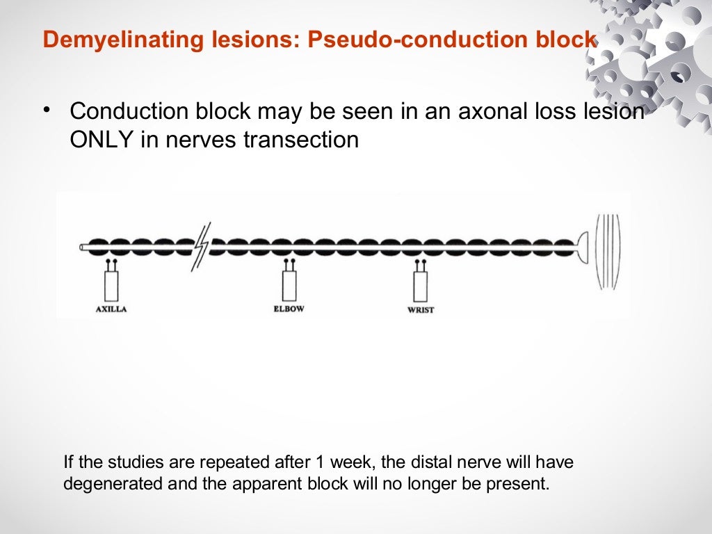 Nerves conduction study, Axonal loss vs Demyelination
