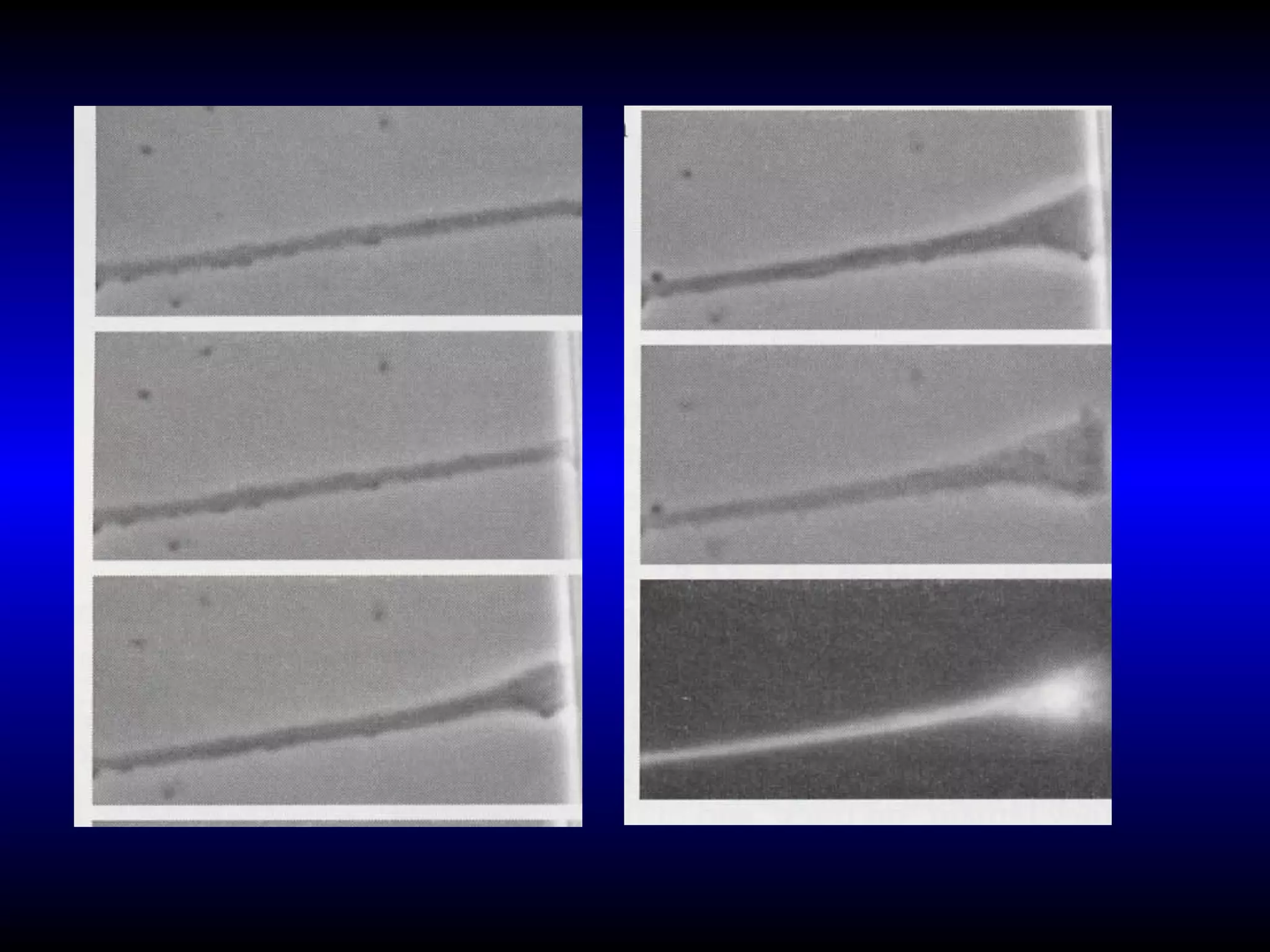 Axoplasmic flow in Axons - Mechanisms and Applications in Clinical ...