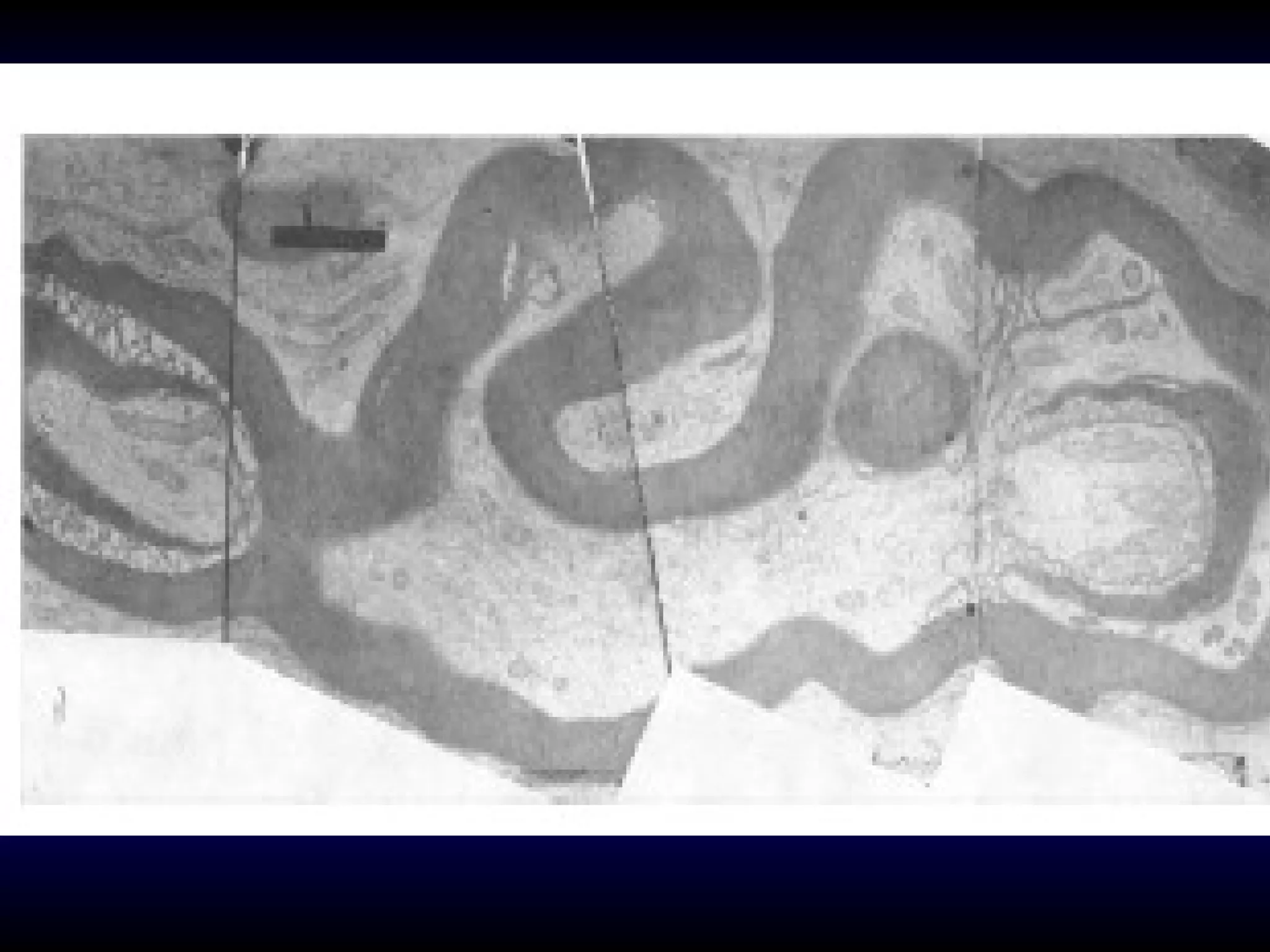 Axoplasmic flow in Axons - Mechanisms and Applications in Clinical ...