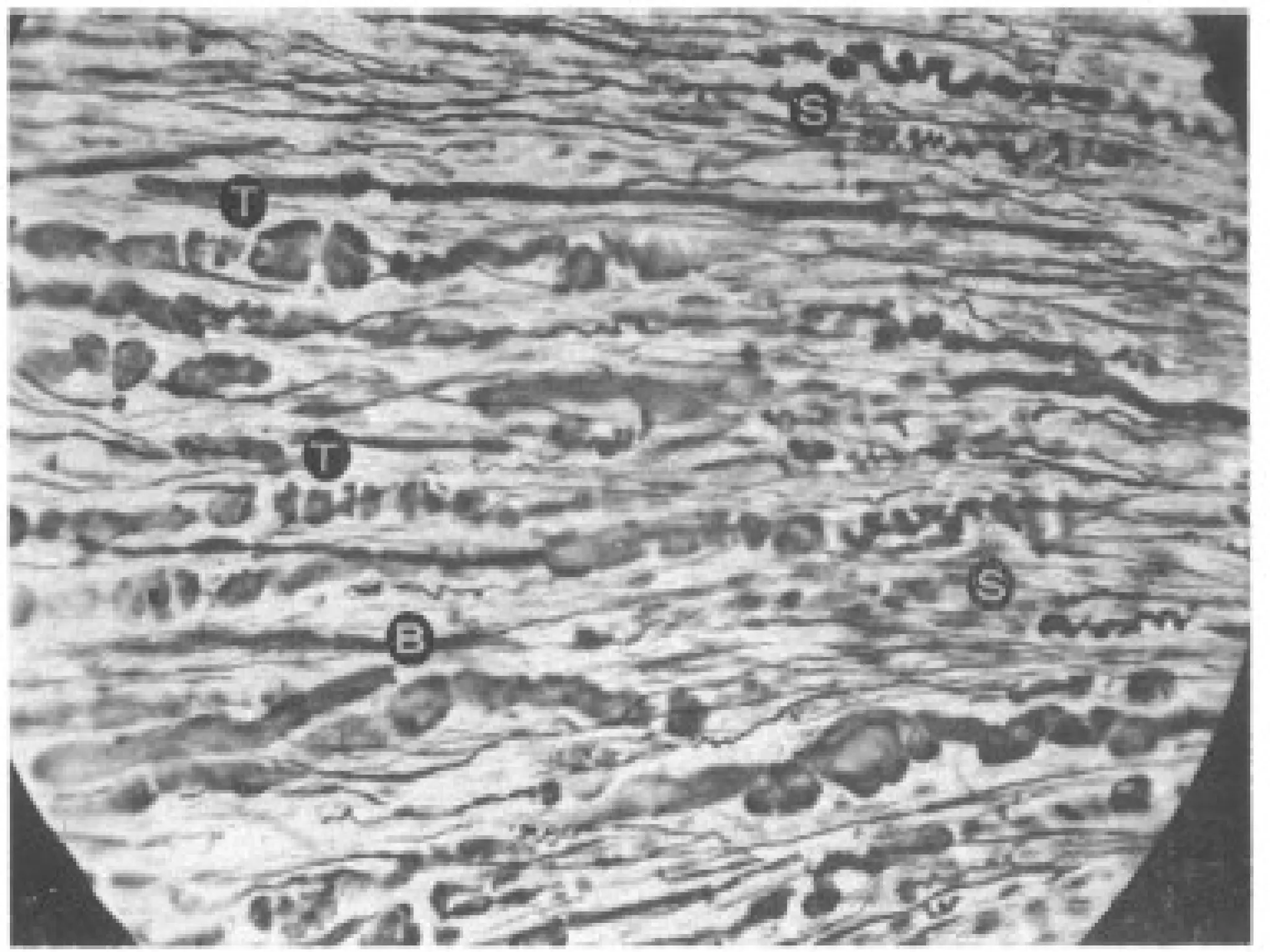 Axoplasmic flow in Axons - Mechanisms and Applications in Clinical ...