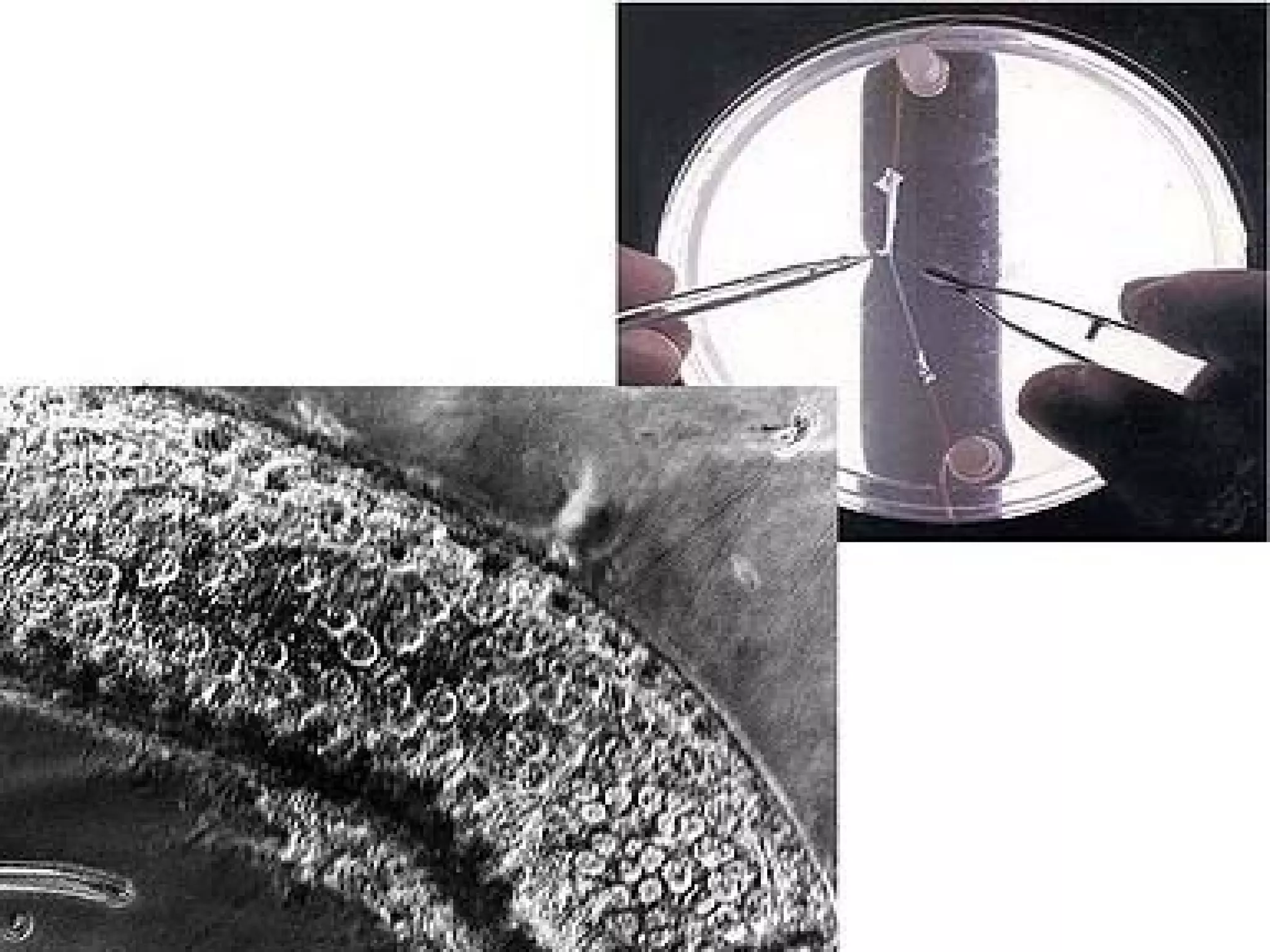 Axoplasmic flow in Axons - Mechanisms and Applications in Clinical ...
