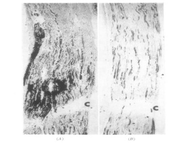 Axoplasmic flow in Axons - Mechanisms and Applications in Clinical ...