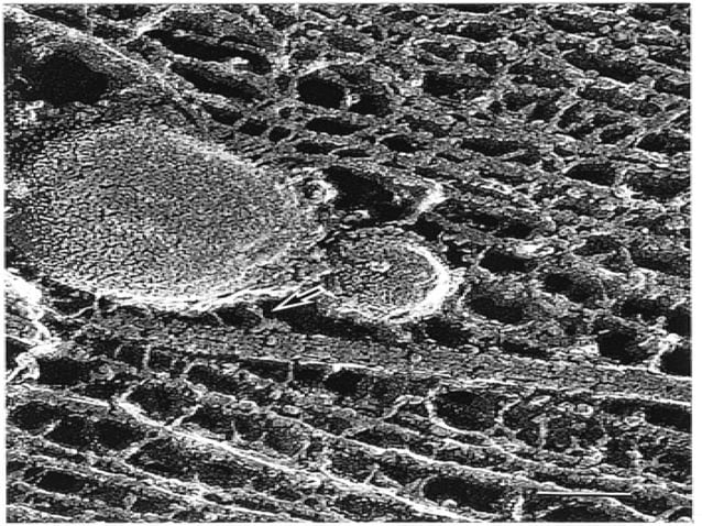 Axoplasmic flow in Axons - Mechanisms and Applications in Clinical ...