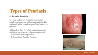 Psoriasis | PPTX