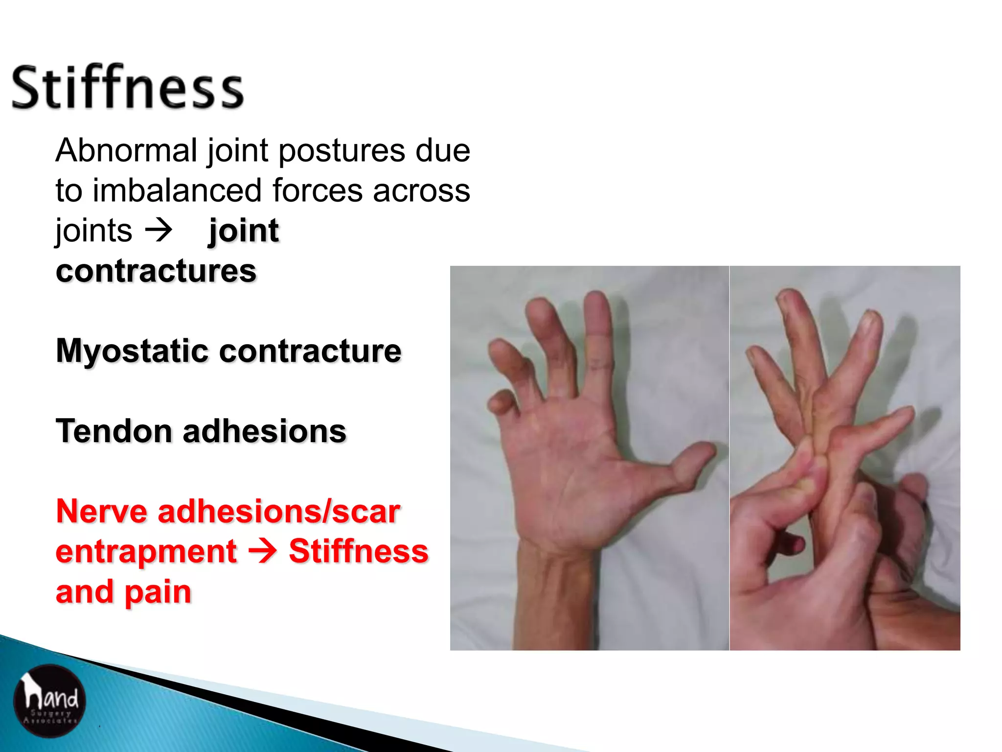 Principles of nerve rehabilitation | PPTX | First Aid | Injuries