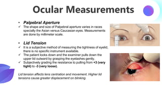 Contact lens pre fitting evaluation and Examination | PDF