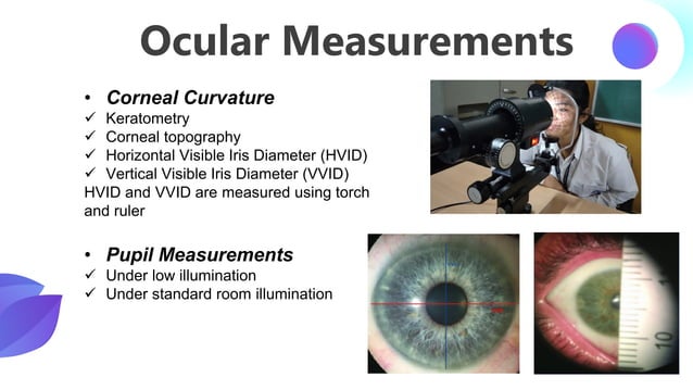 Contact lens pre fitting evaluation and Examination | PDF