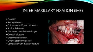 Mandibular fracture and its Management | PPTX