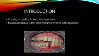 Mandibular fracture and its Management | PPTX
