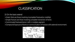 Mandibular fracture and its Management | PPTX