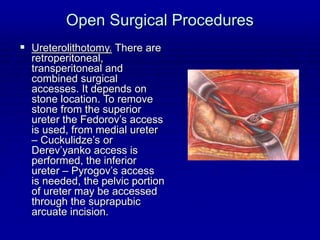 Urolithiasis ppt.pptx | Digestive Disorders | Diseases and Conditions