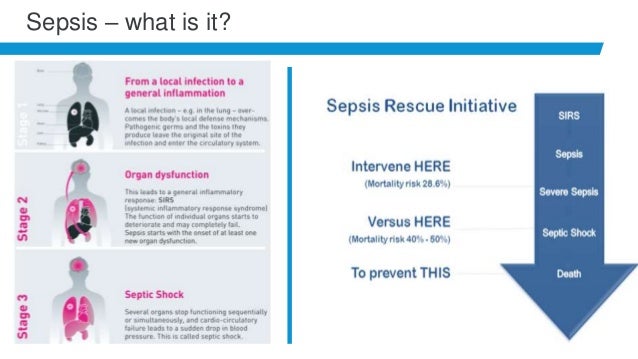 Using the EMR in early recognition and management of sepsis