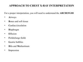 How to interpret the chest x- ray.. .pptx