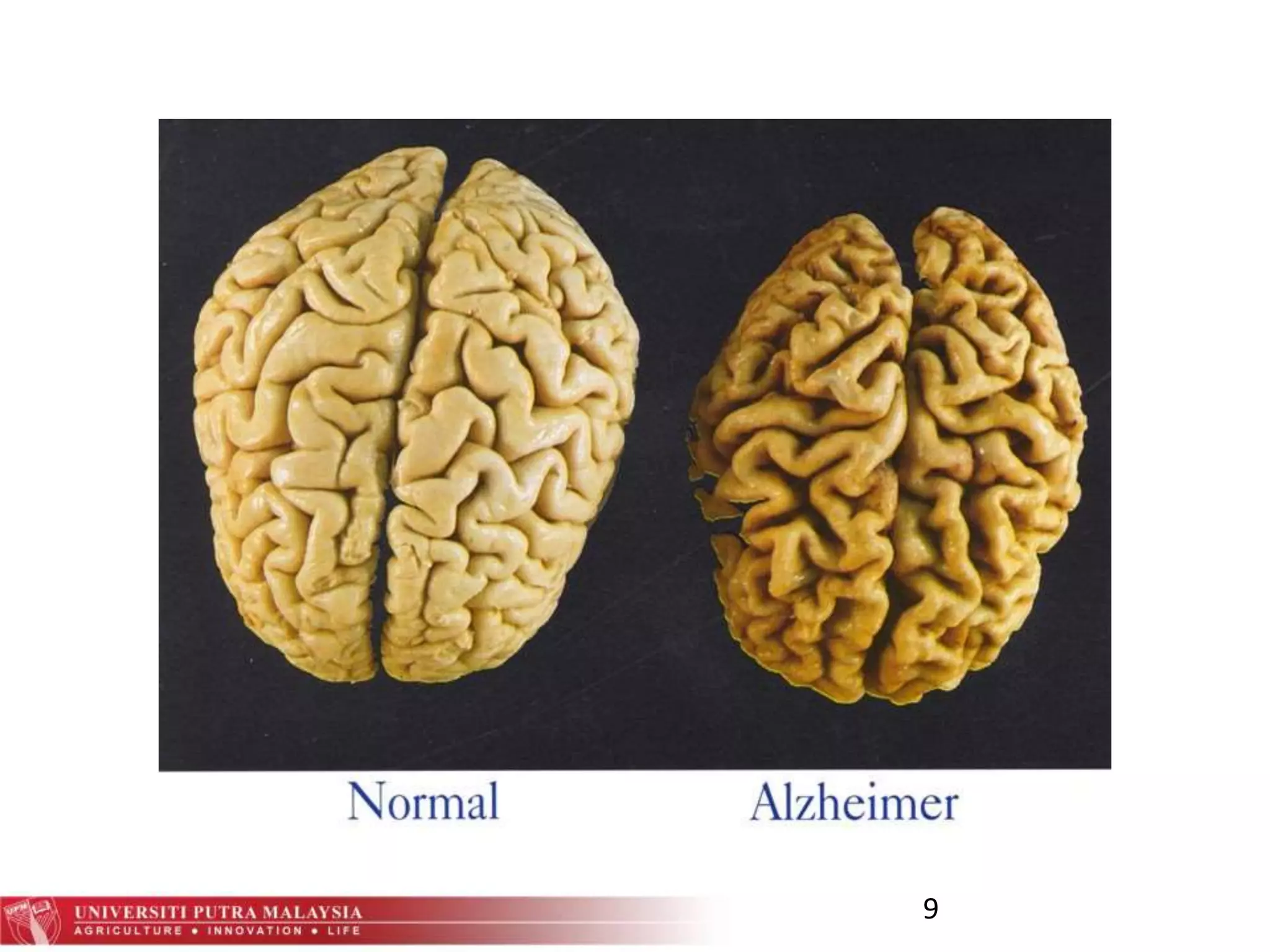 NEUROCOGNITIVE DISORDER (NCD) | PPT