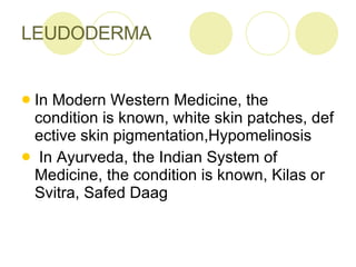 Ayurveda Cure Of Leucoderma | PPT