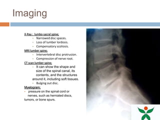 Ayurvedic management of disc prolapse | PPTX