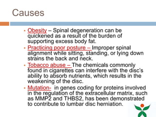 Ayurvedic management of disc prolapse | PPTX