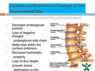 Ayurvedic management of disc prolapse | PPTX