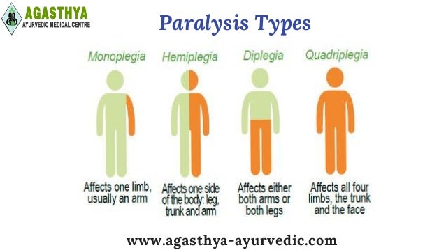 Ayurvedic Treatment For Paralysis In Kerala | Ayurvedic Clinic In India