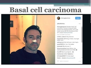 Cancer is a group of diseases that occur when cells grow out of control ...