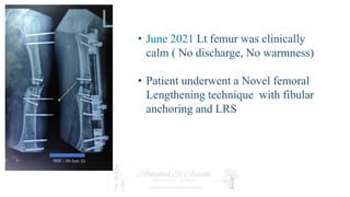 Complex Femoral Fracture Scenario | PPT