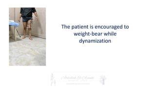 Complex Femoral Fracture Scenario | PPT
