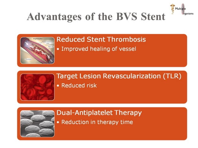 Bioabsorbable Drug-Eluting Cardiac Stent Analysis | PPT