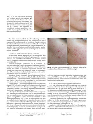 Azelaic Acid in the Treatment of Acne in Adult Females: Case Reports | PDF